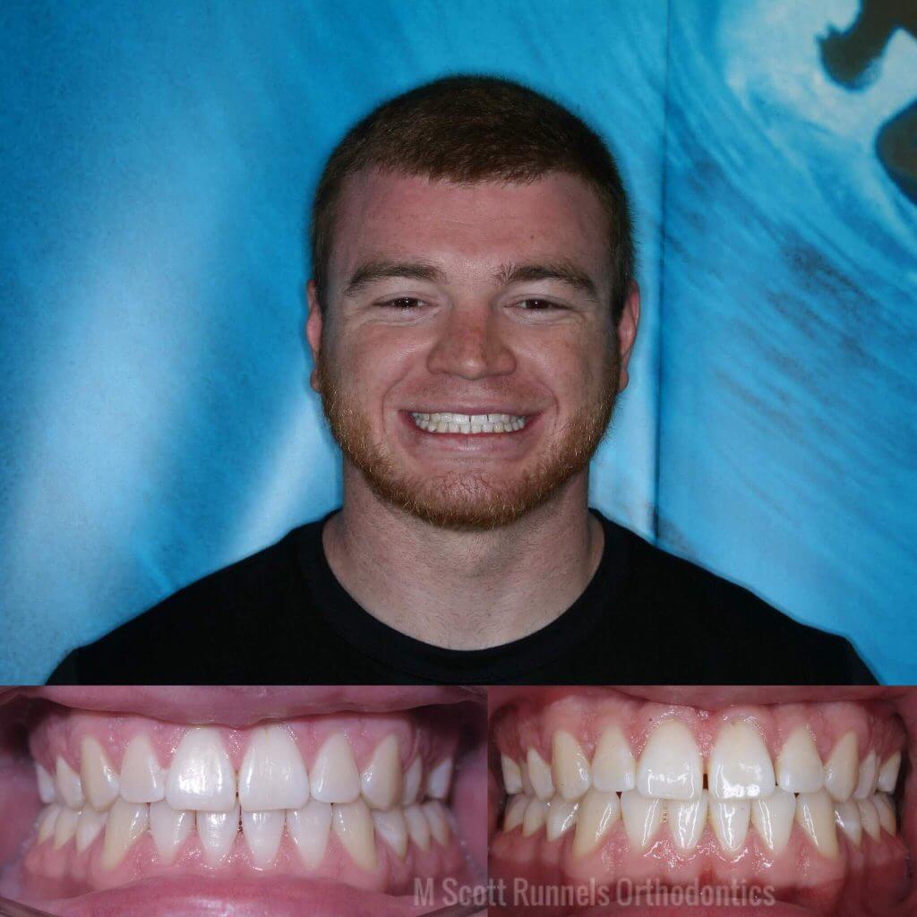 Gallery - M. Scott Runnels D.M.D., P.A.